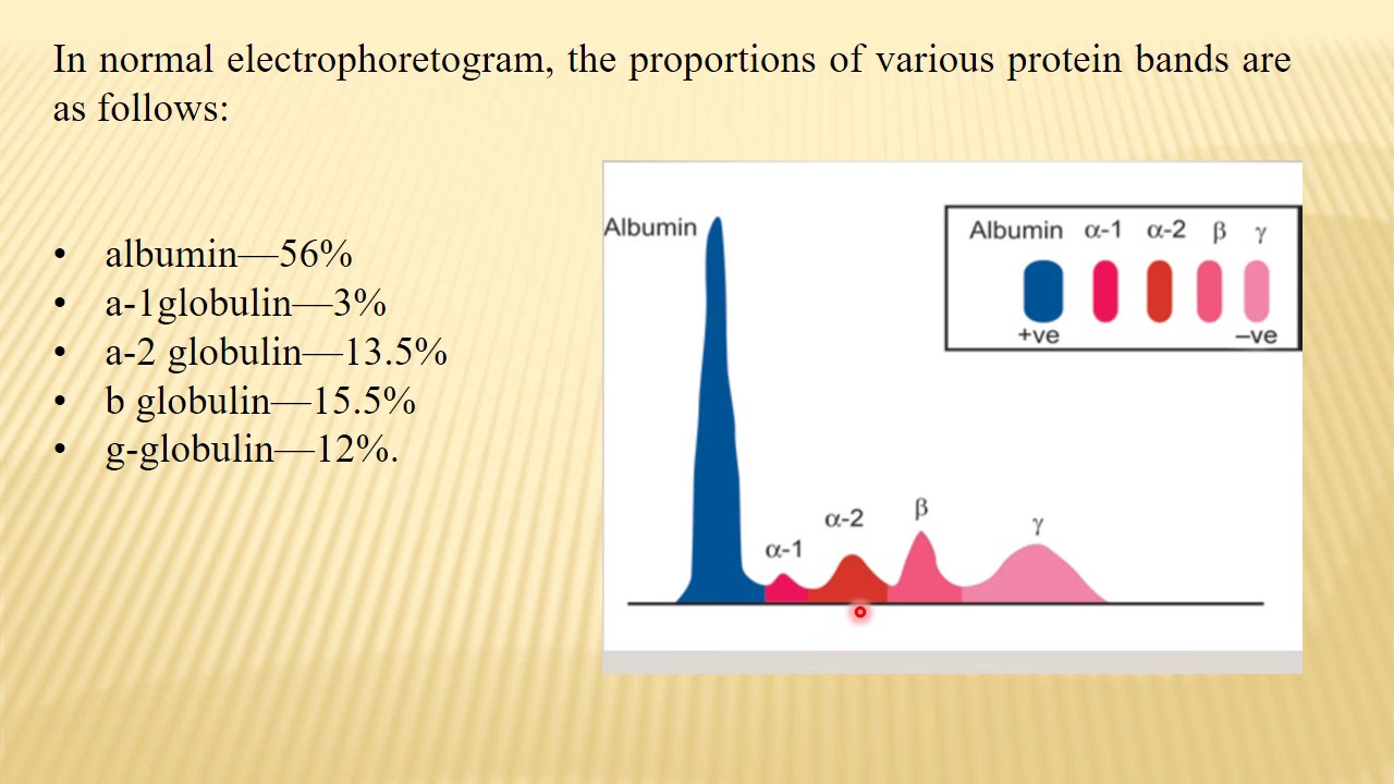 First Week Protein Electrophoresis YouTube first-week-protein-electrophoresis-youtube