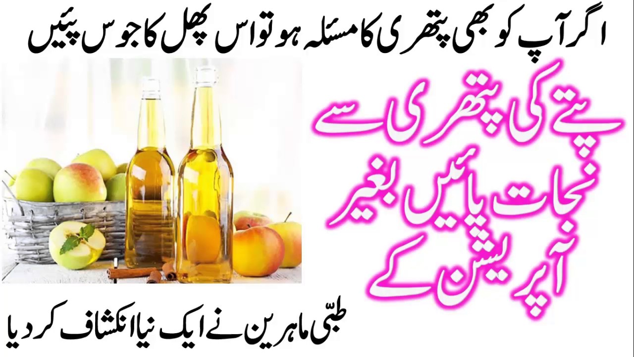 Pitta ki pathri ka Ilaj | Gall Bladder Stone Treatment | پتے کی پتھری ...