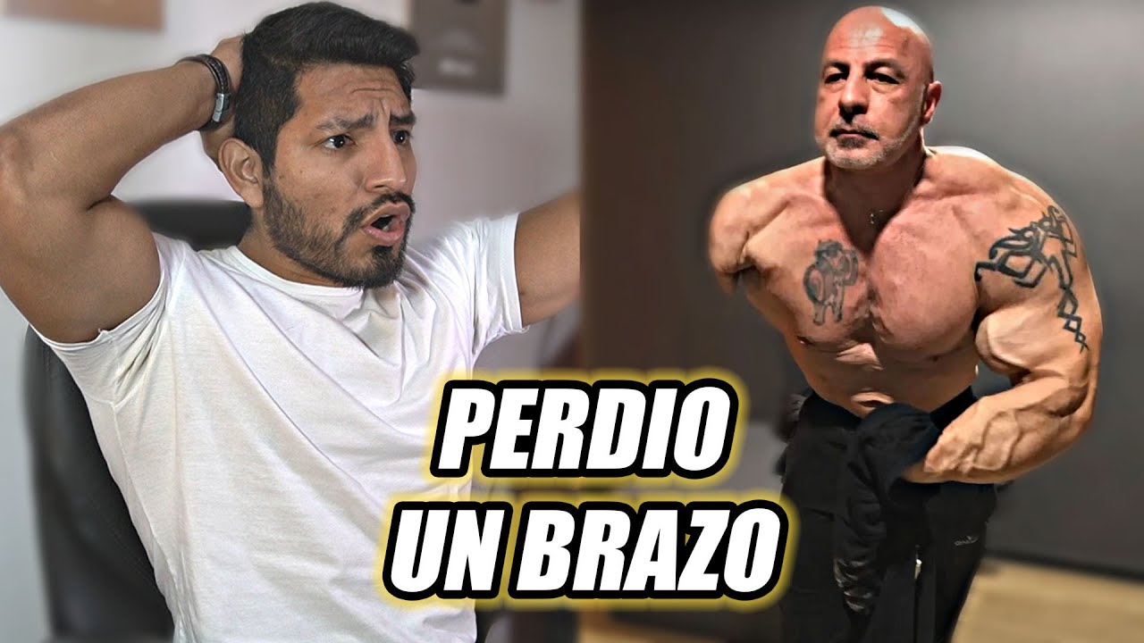 EL CULTURISTA que PERDIÓ un BRAZO - Increíble Fisicoculturista sin un ...
