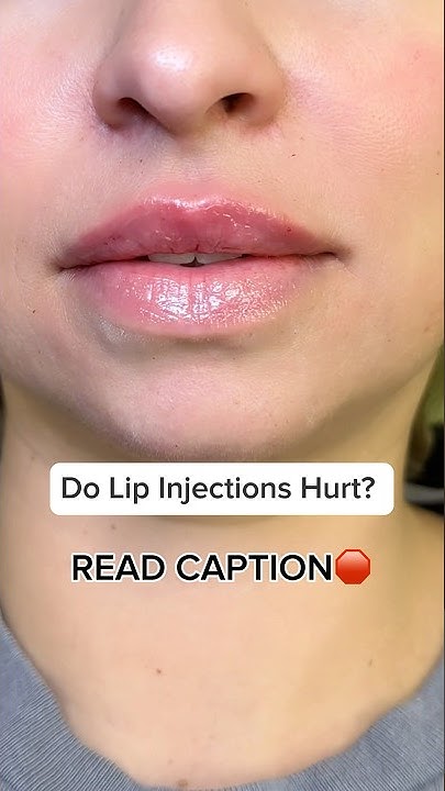 Do lip injections hurt? 💋 #lipfillers #lips #fillersinjection #fillers - YouTube