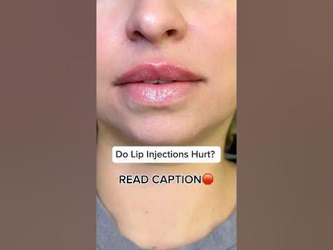 Do lip injections hurt? 💋 #lipfillers #lips #fillersinjection #fillers - YouTube