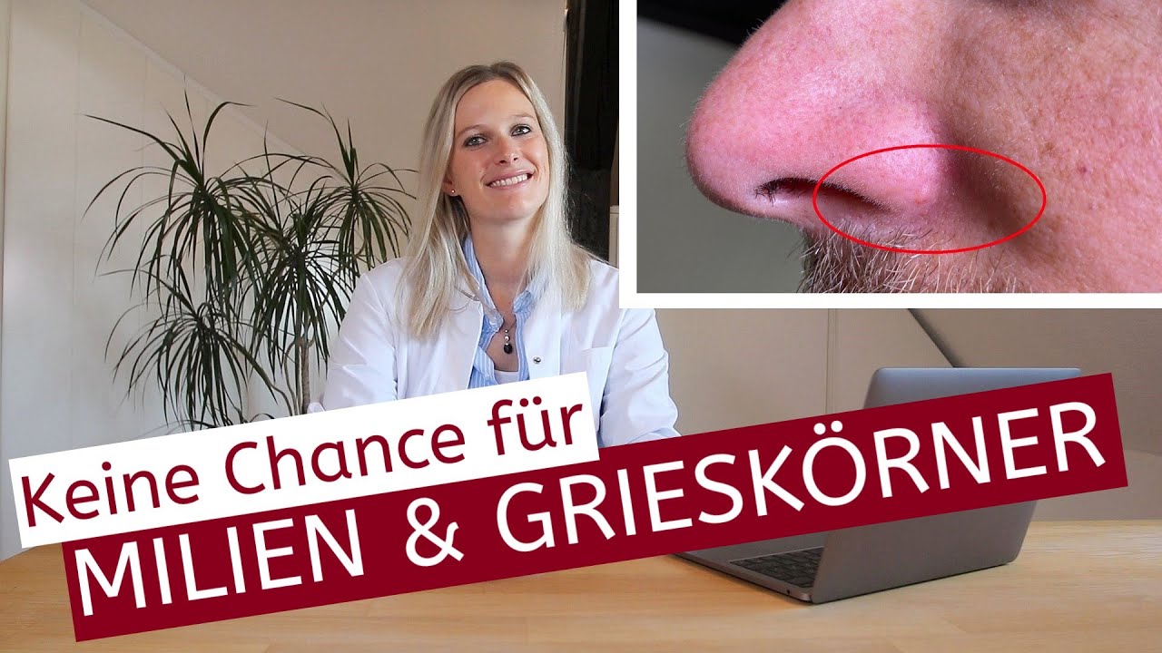 Keine Chance für Milien & Grieskörner | Kosmetik | Pflege | Behandlung ...