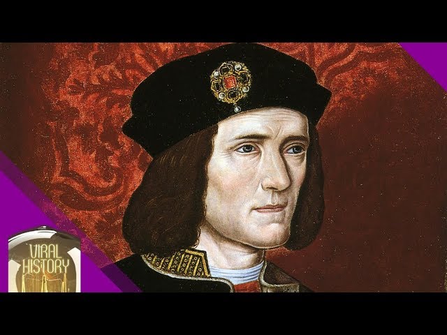 Richard Iii Deformity