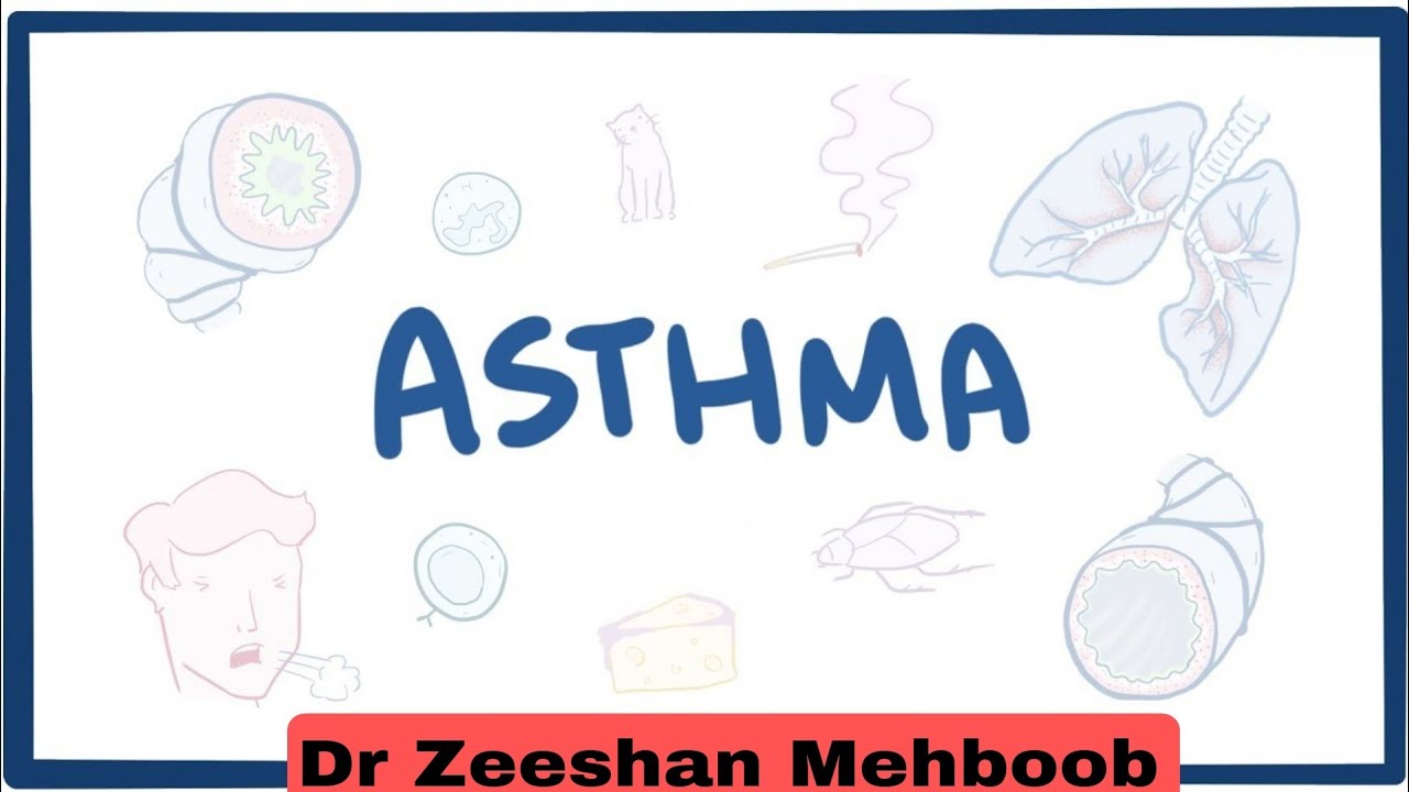 دمہ کو ہمیشہ کے لیے ختم کر دیں۰Permanent Treatment of Asthma | Blatta ...