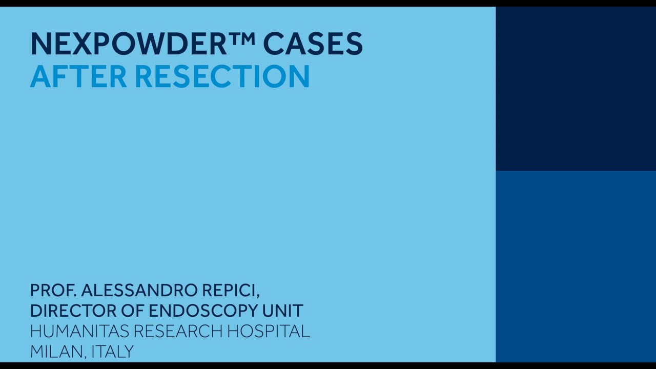 Nexpowder™case after resection Dr Repici, Italy - YouTube