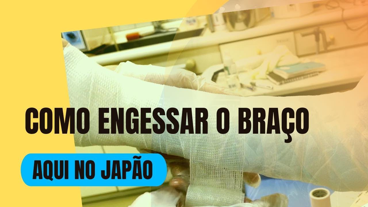 COMO COLOCAR GESSO NO BRAÇO: ortopedista no JAPÃO - YouTube