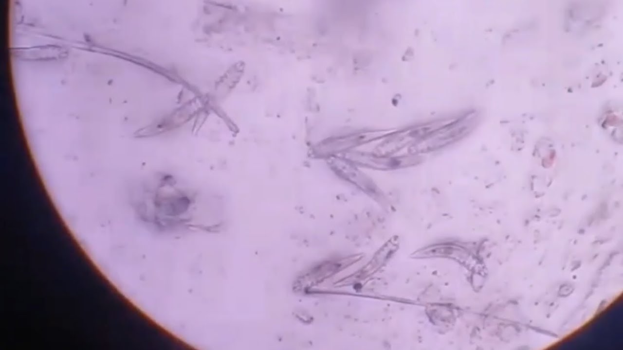 Demodectic Mange in Dogs / Microscopic View - YouTube