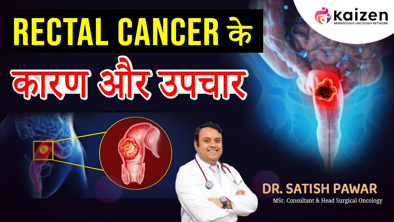 Rectal cancer: Causes and Treatment | कैंसर | Dr.Satish Pawar | Kaizen ...