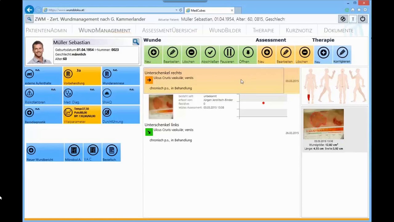 MedCubes Wunddokumentation - YouTube
