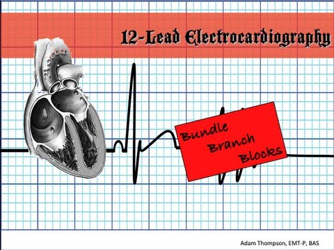 Bundle Branch Blocks - Part 1 - YouTube