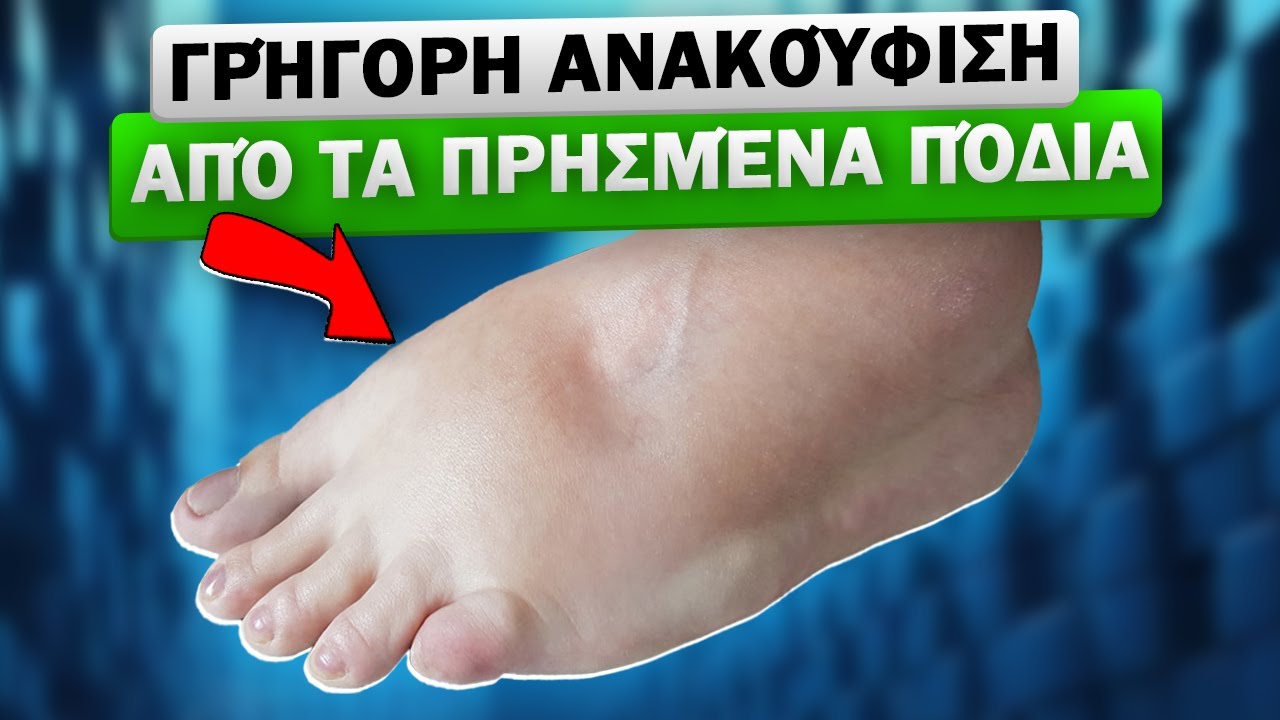 Πώς ένας παλιός γενικός γιατρός με έσωσε από πρησμένα άκρα! Πρήξιμο των ...