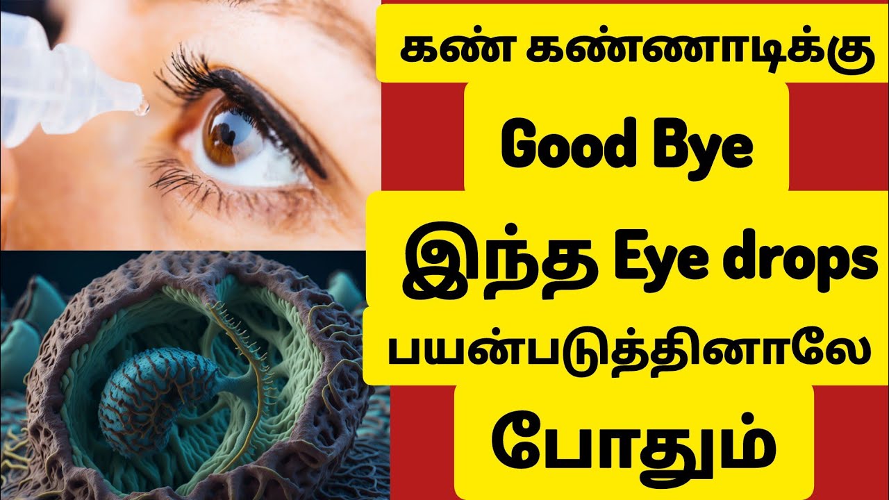 கண் கண்ணாடிக்கு குட்-பாய் /Magic Eye drops #tamil - YouTube