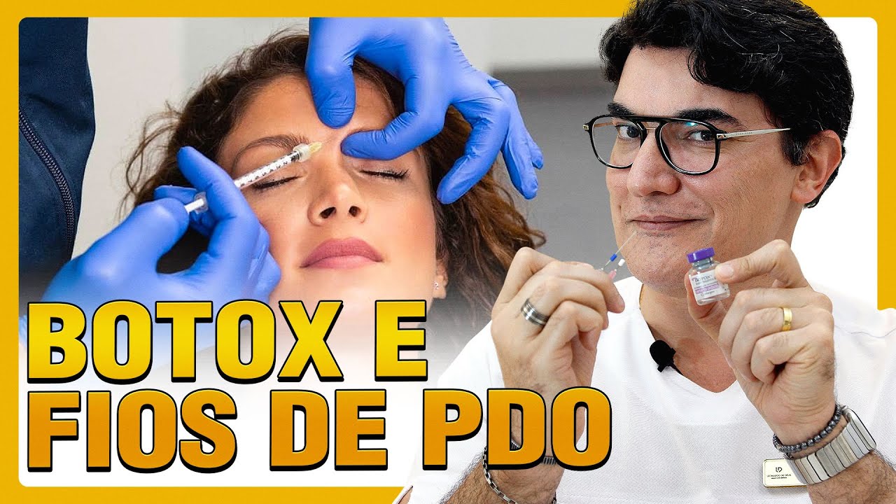 BOTOX e FIOS DE PDO - YouTube