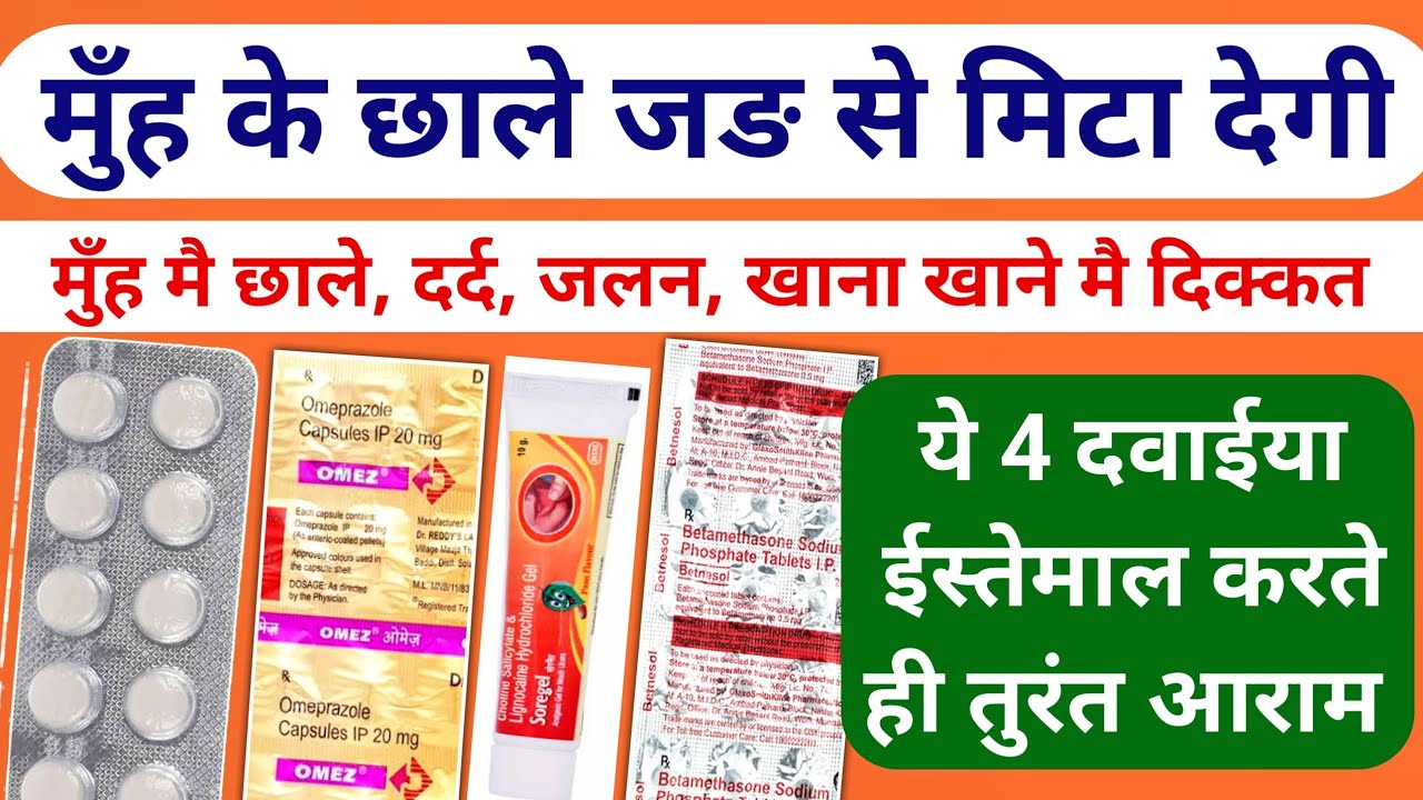 मुंह के छाले जड़ से खत्म करे Muh ke chale ki Medicine | muh ke chale ...