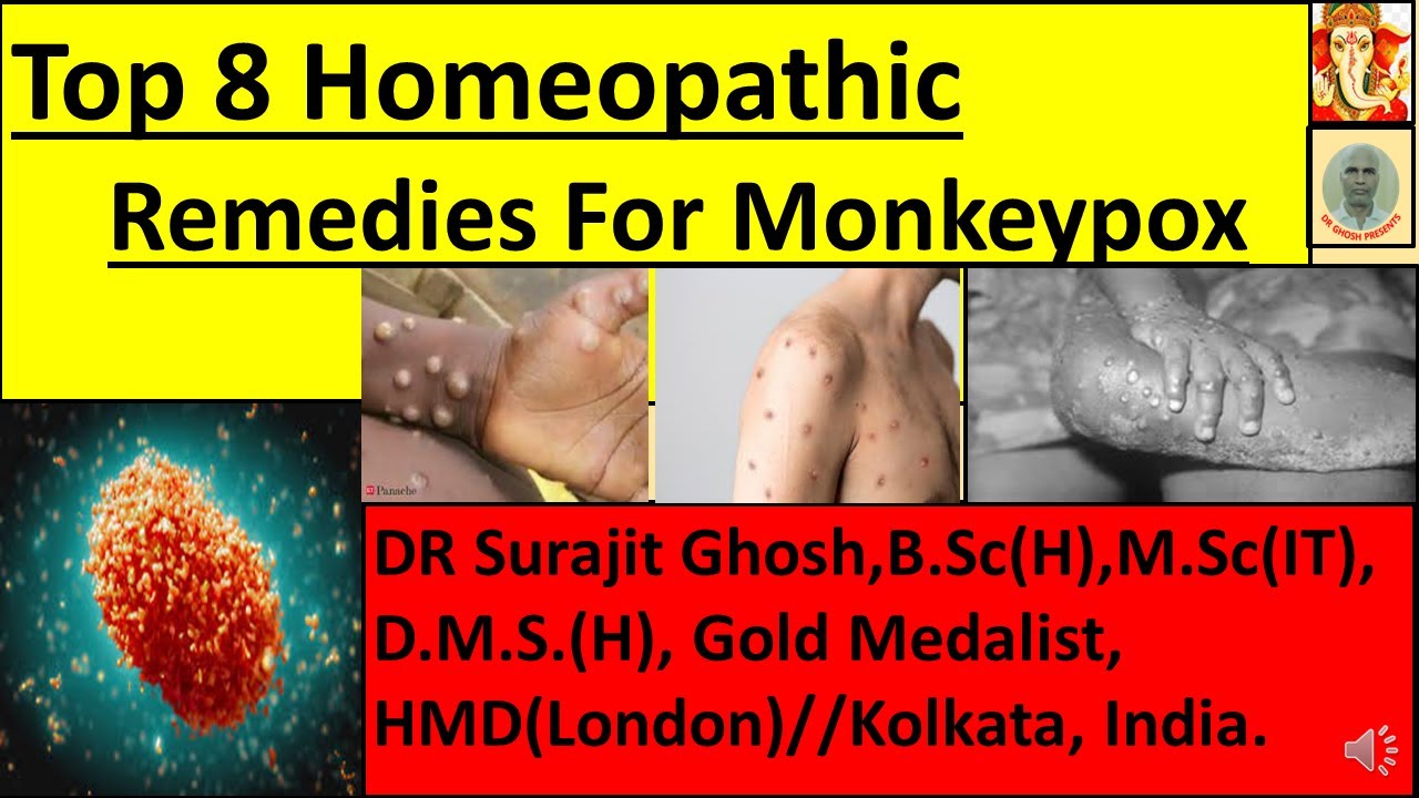 TOP 8 HOMEOPATHIC REMEDIES FOR MONKEYPOX - YouTube