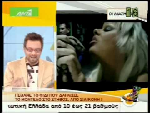 ΡΑΔΙΟ ΑΡΒΥΛΑ ΤΟ ΦΙΔΙ ΠΟΥ ΔΑΓΚΩΣΕ ΤΟ ΜΟΝΤΕΛΟ. - YouTube