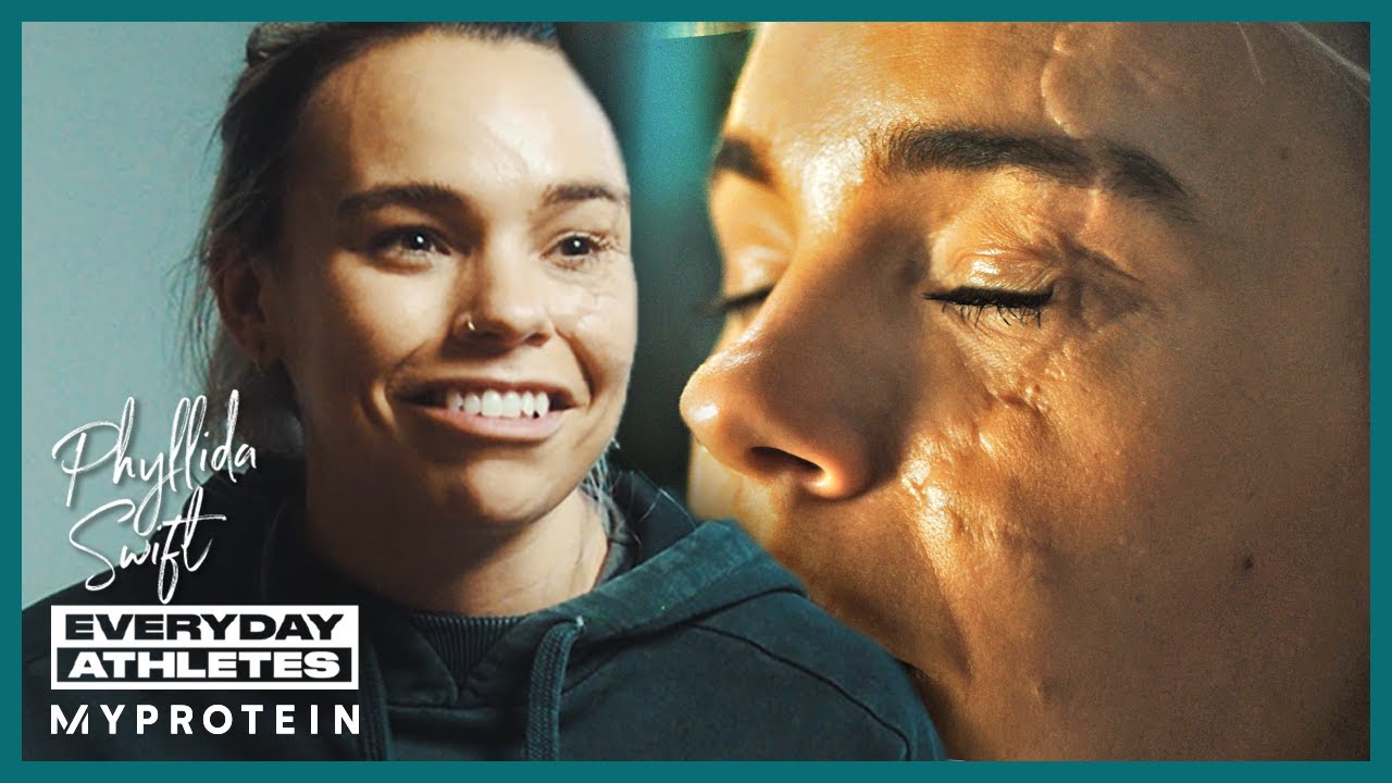 “My Scars Have Given Me A Purpose” - Athlete On Her Facial ...