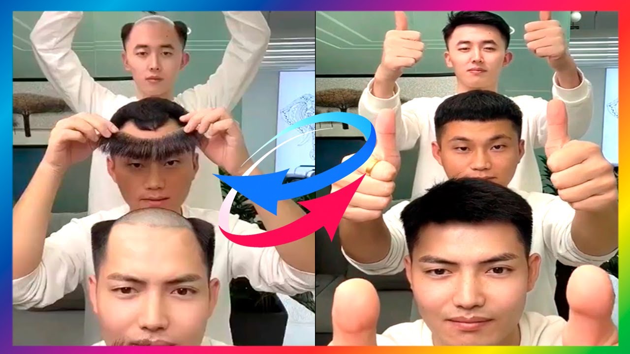 Amazing hair transformation😱 Hair Overlay😎 Hair wig👍/ hair patch, hair ...