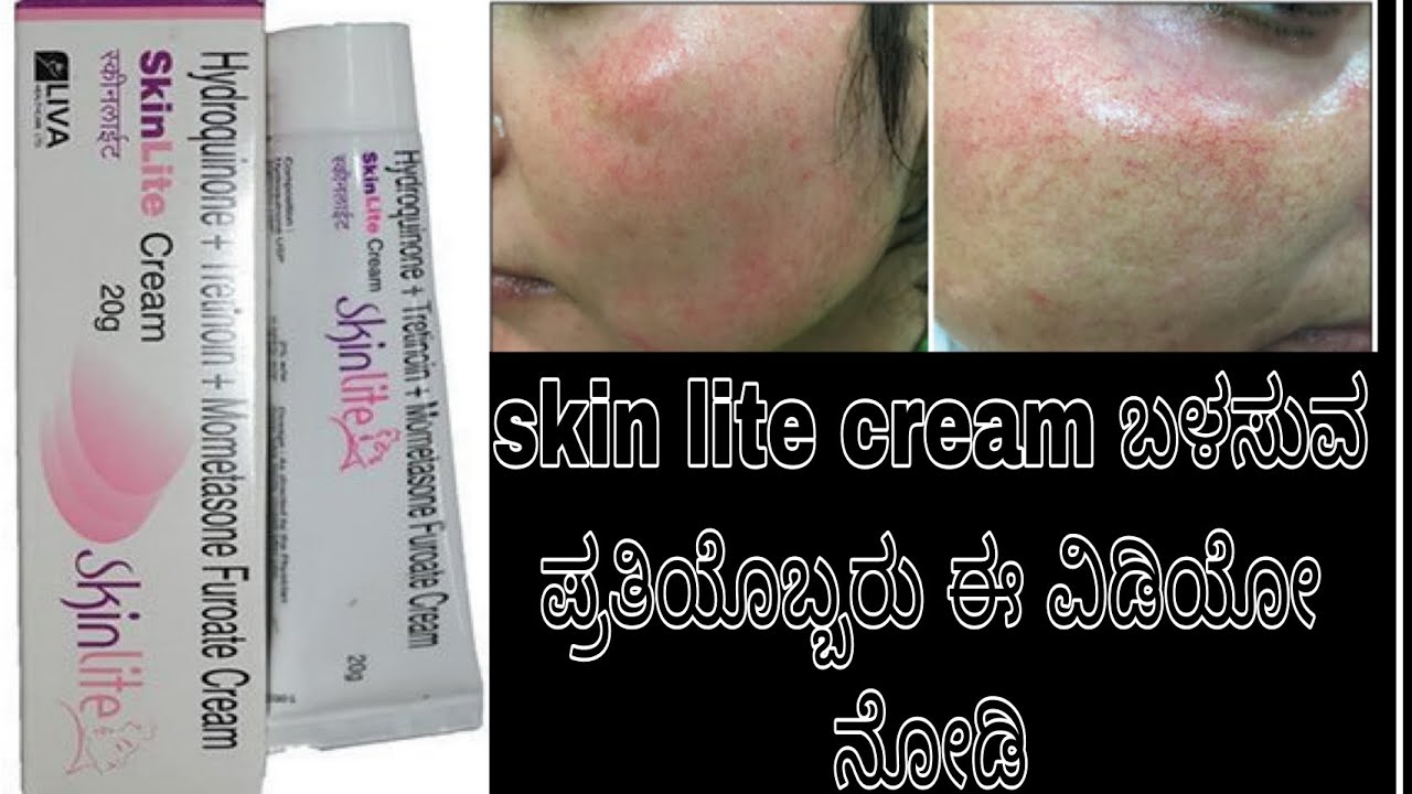 Skin lite Cream Review In Kannaada||Skin whitening|| Side Effects ...