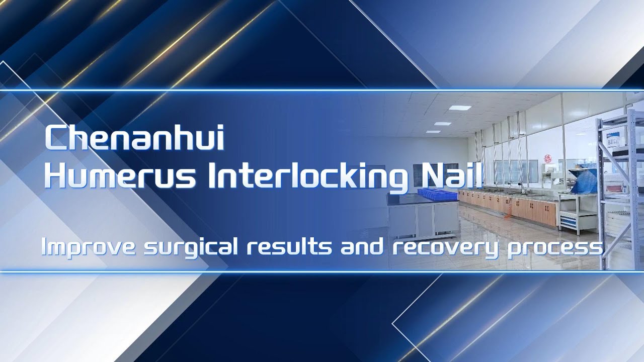 Humerus Interlocking Nail -- Excellent fixation and stability! - YouTube