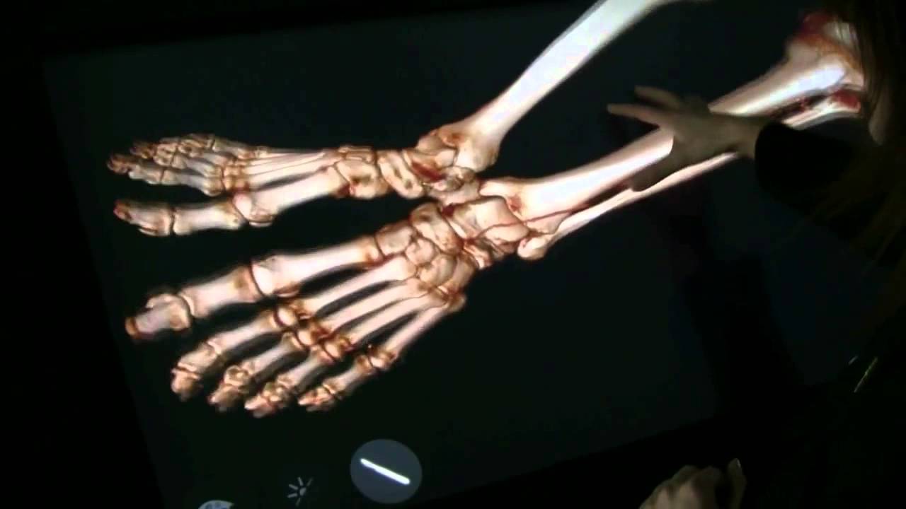 Sectra Visualization Table Improved medical education2 - YouTube