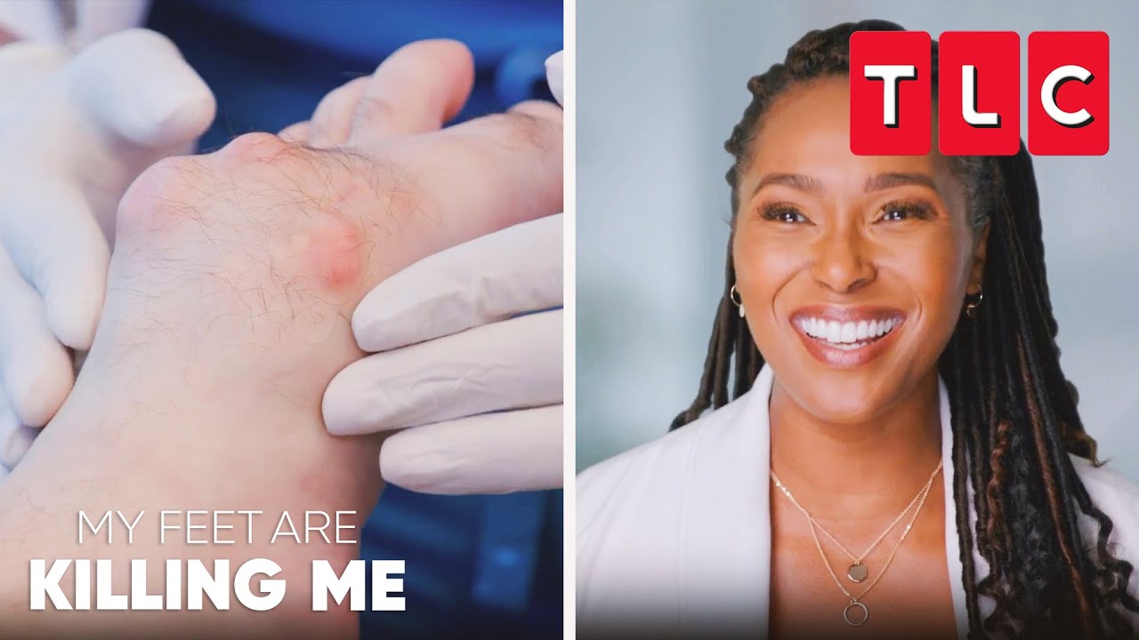 Most Mysterious Growths | My Feet Are Killing Me | TLC - YouTube