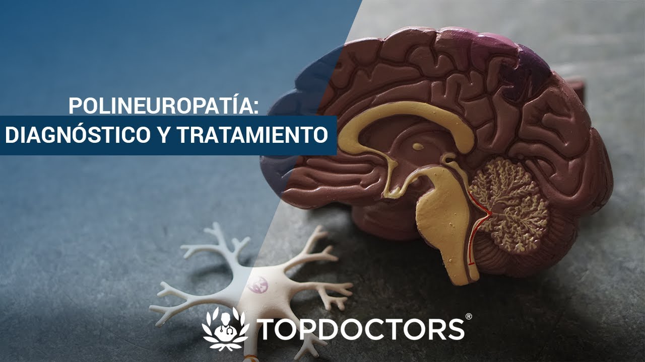 Polineuropatía: diagnóstico y tratamiento - YouTube
