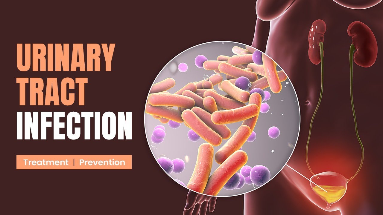 What is the main cause of Urinary Tract Infection (UTIs),Treatment and ...