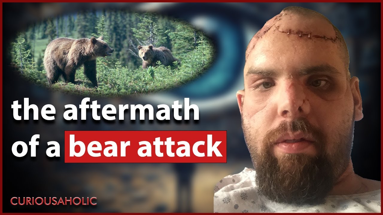 Jeremy Evans Hiked 12Kms After Being Mauled - YouTube