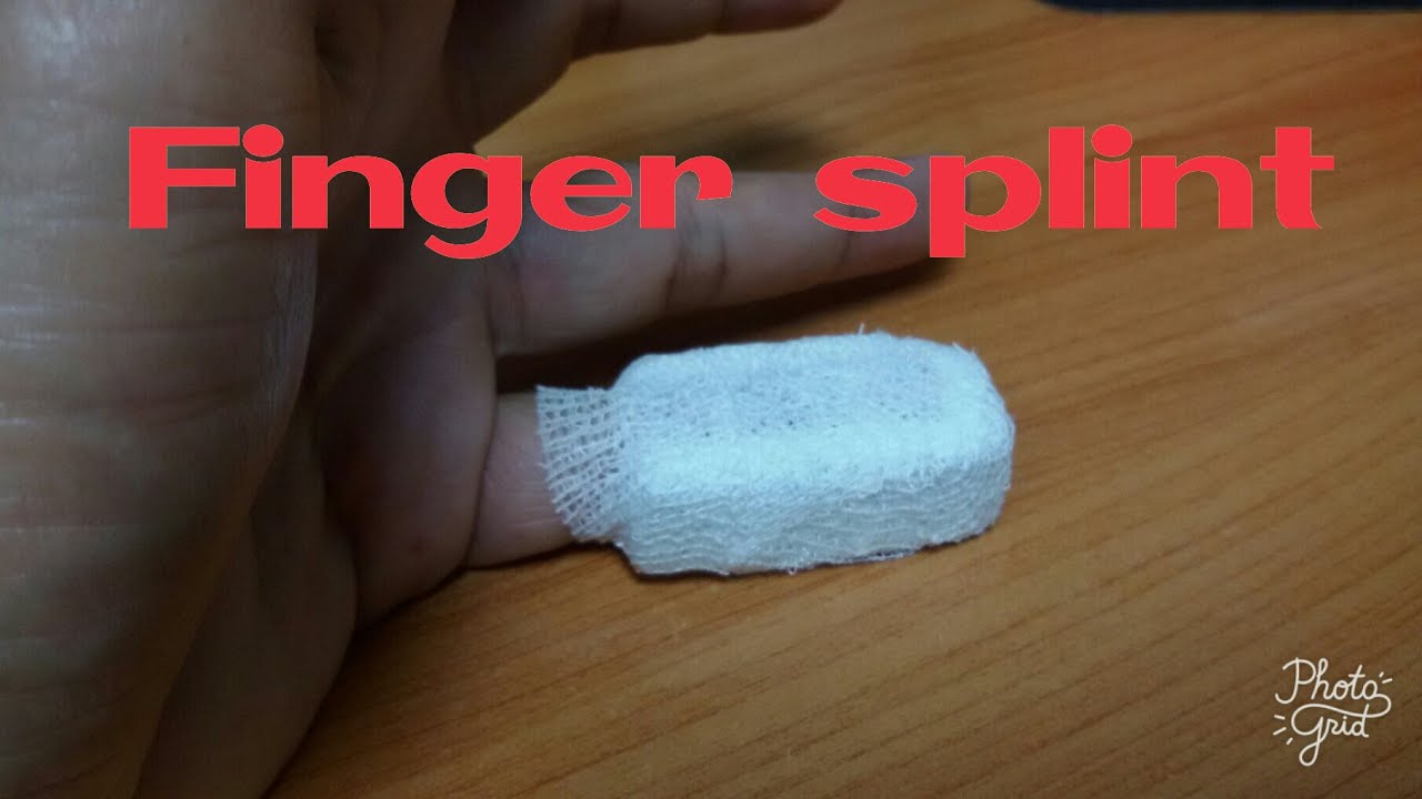 Application aluminium splint by RAKE Krittanai - YouTube