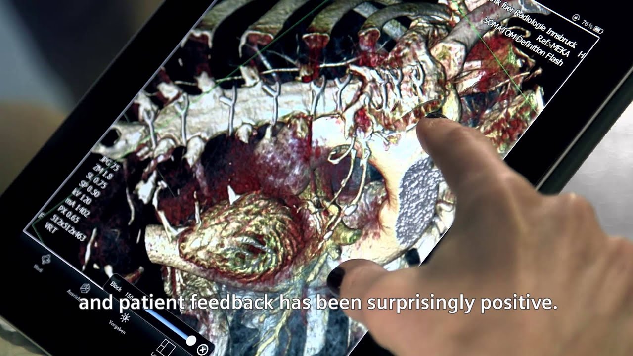 Radiology on the go with syngo.via WebViewer mobile app - YouTube