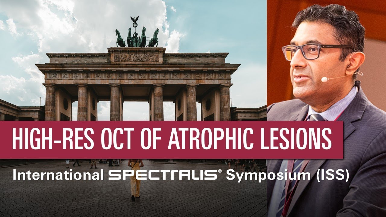 High-Resolution OCT Imaging of Atrophic Lesions Associated with AMD ...