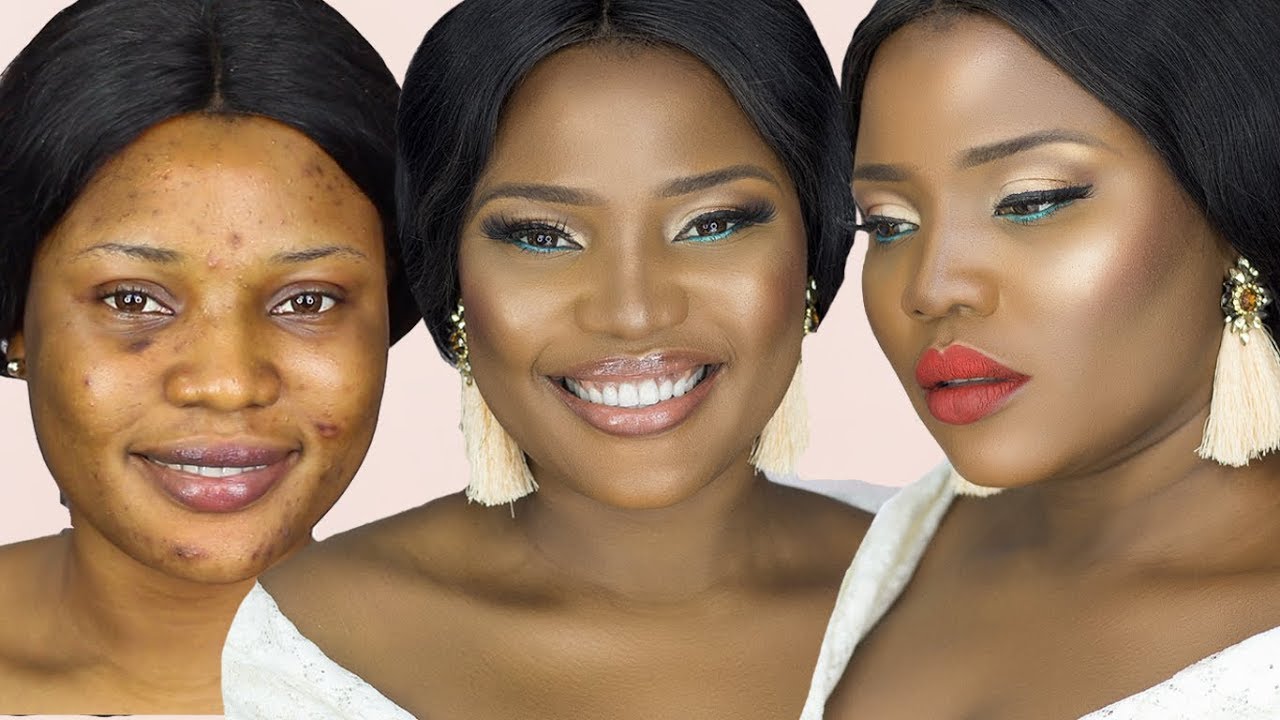 HOW TO: Flawless Makeup on Acne Breakout Skin | Makeup Tutorial - YouTube