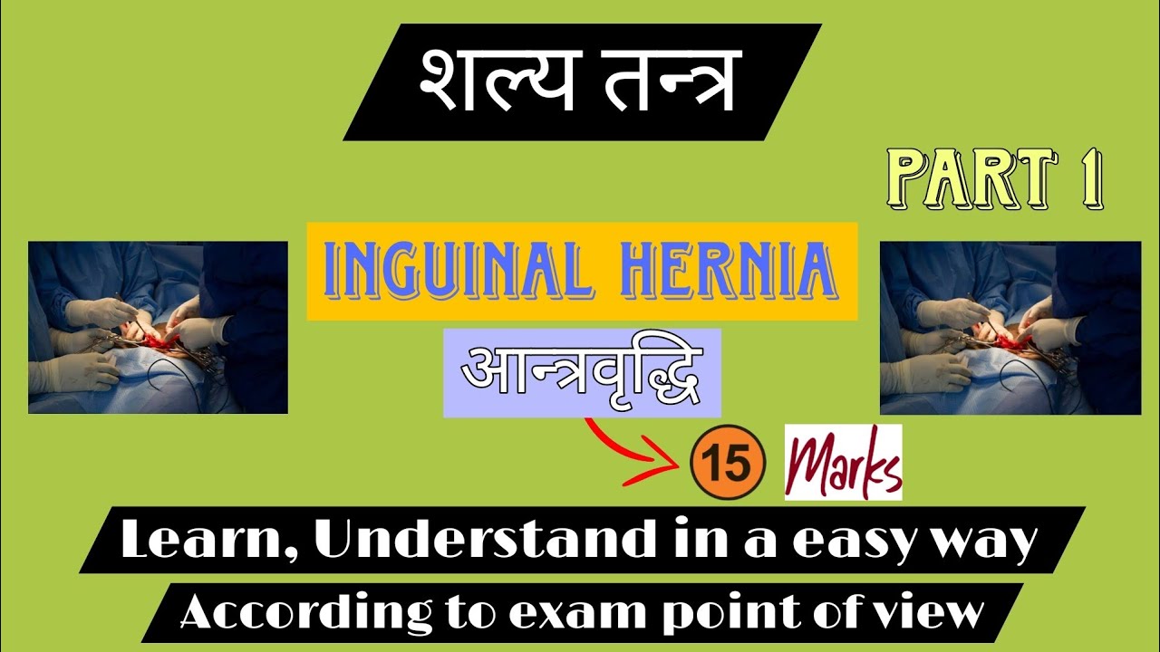 Inguinal hernia | Part 1 | आन्त्रवृद्धि | Inguinal hernia notes ...