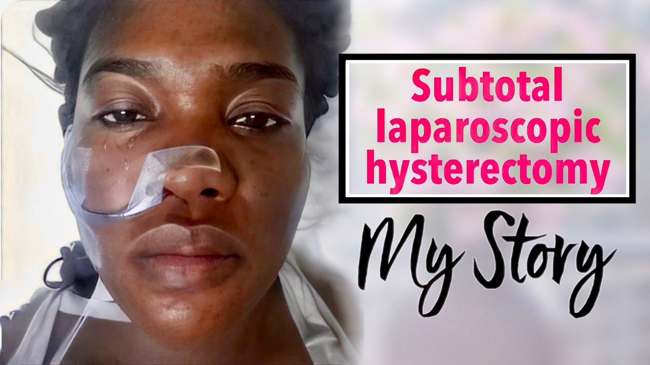 My Subtotal Laparoscopic Hysterectomy Story - YouTube