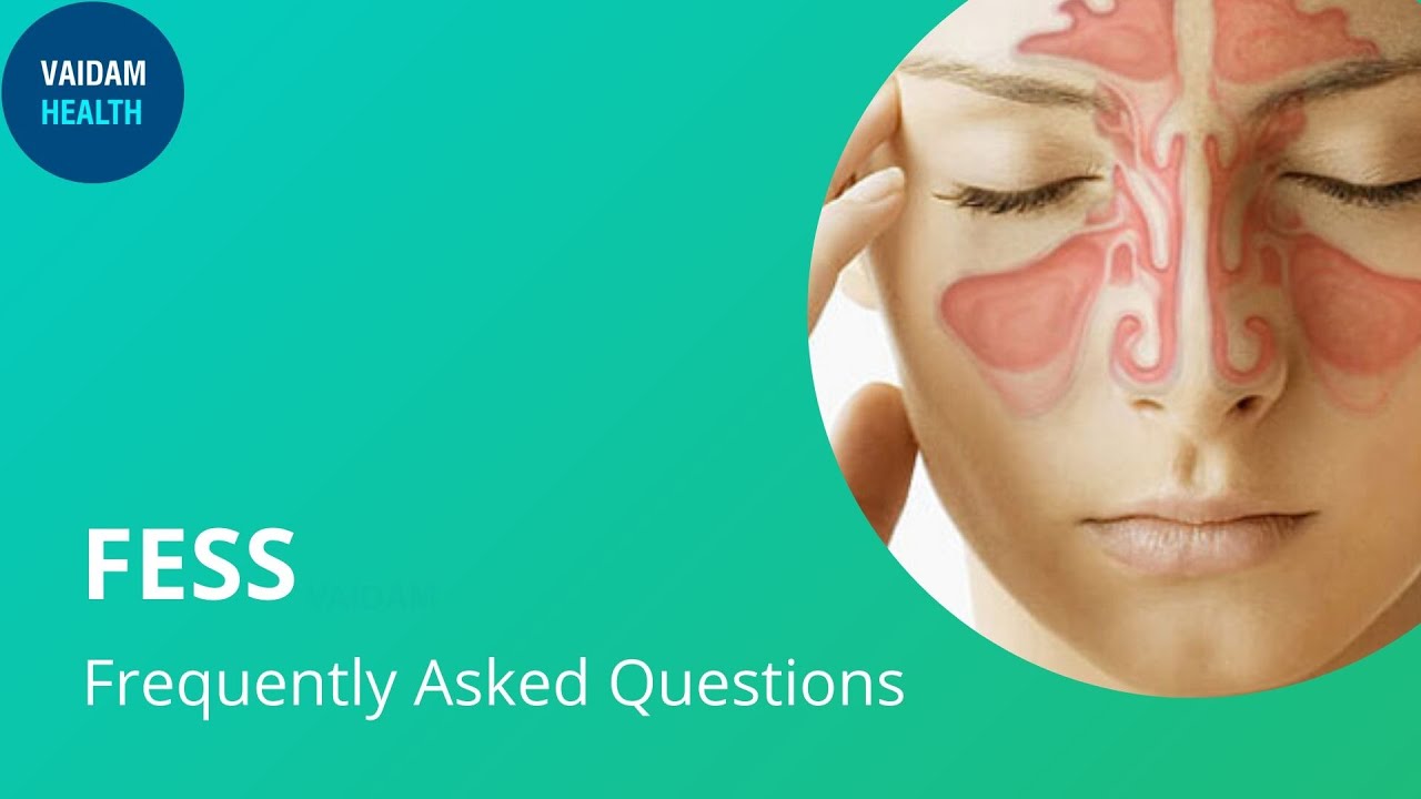 FESS- Frequently Asked Questions - YouTube