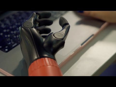 CYBI Hand - Body-Powered Prosthetic Hand - YouTube