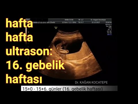16. gebelik haftasında anne karnındaki erkek bebek - açıklamalı ultrason görüntüleri