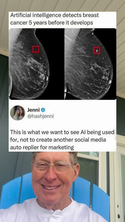 AI Detects Cancer 5 Years Before it Develops. (grandpa) - YouTube