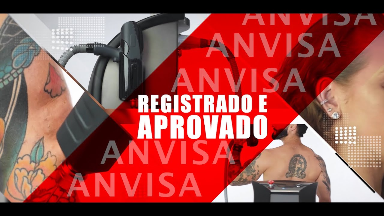 Q Clean - Laser Q-Switched para despigmentação de tatuagem ...