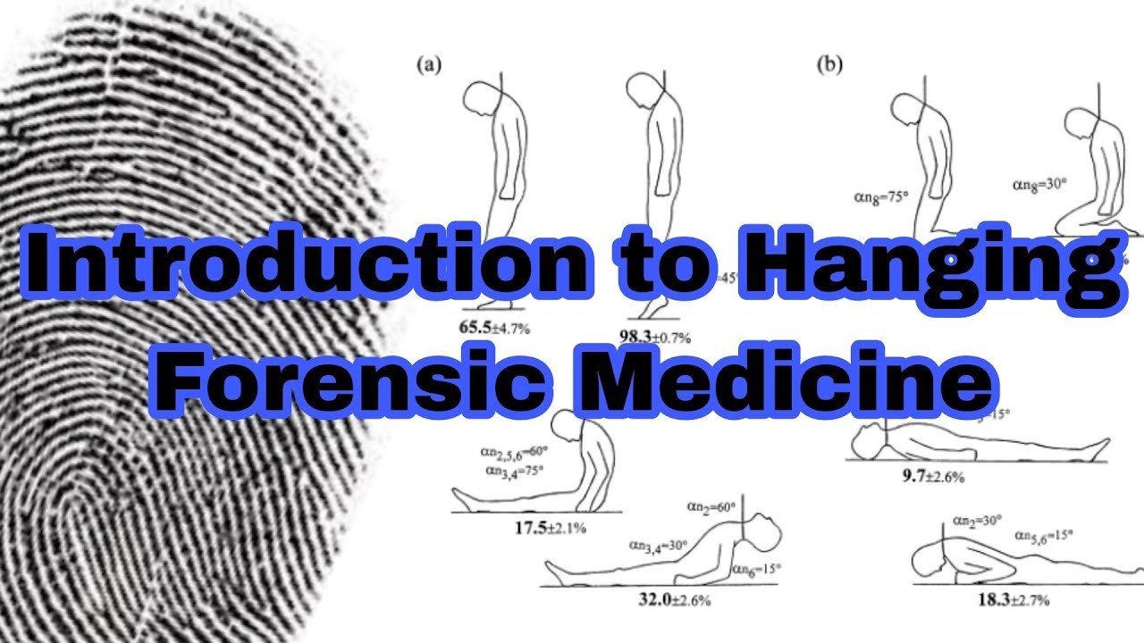 Introduction to Hanging II Asphyxial Deaths || Forensic Medicine - YouTube