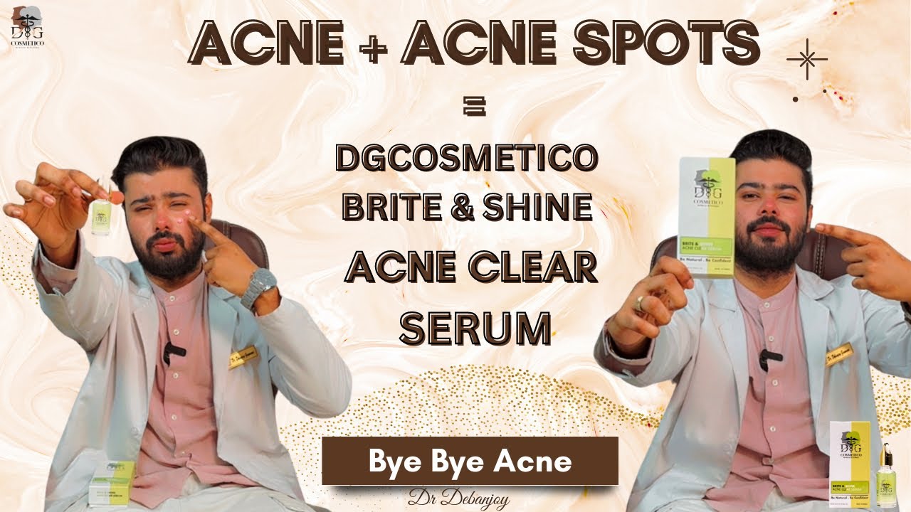 “BYE ACNE AND ACNE SPOTS TOGETHER”. Unveiling the secret to ACNE FREE ...