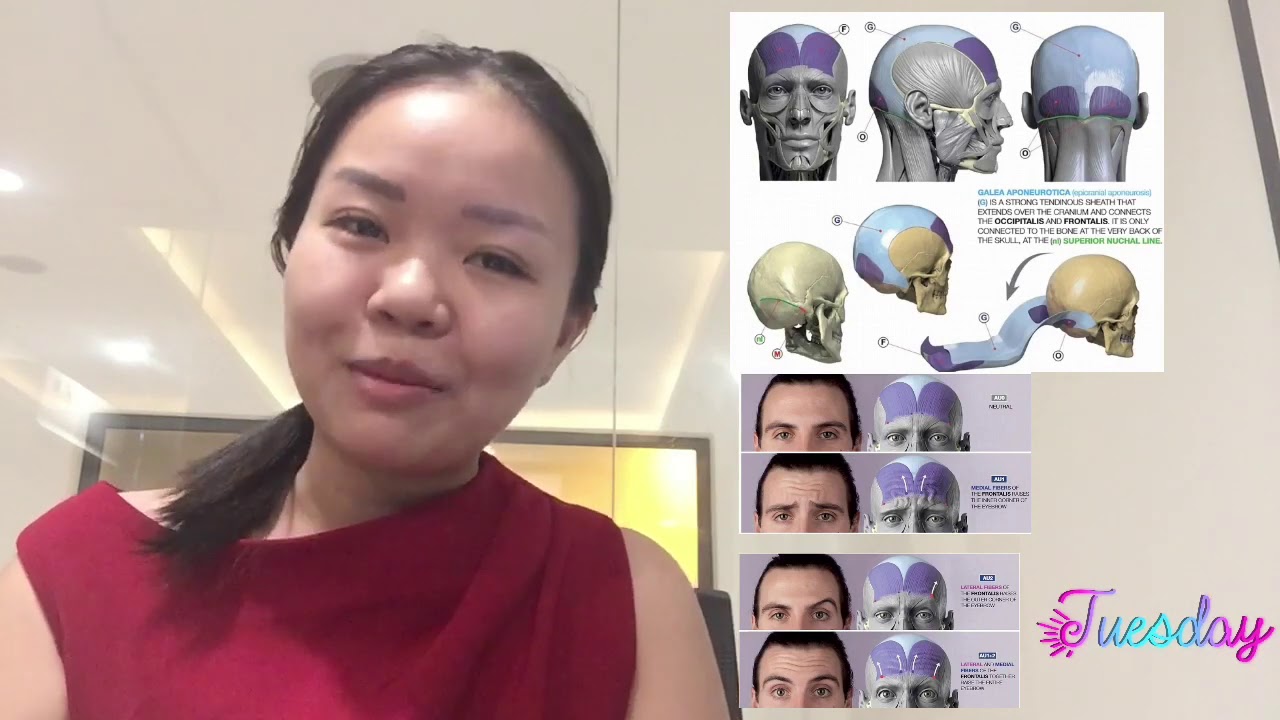 Frontalis muscle in Botox - YouTube