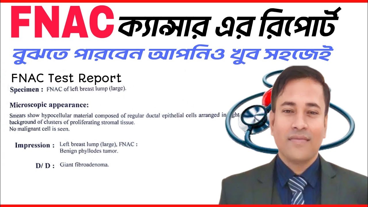 FNAC পরীক্ষা কেন করা হয়? FNAC TEST REPORT কীভাবে বুঝবেন। FNAC। CANCER ...