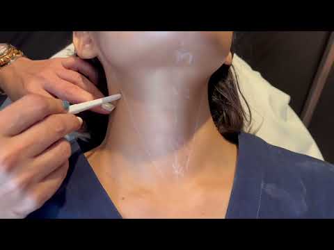 Profhilo Neck