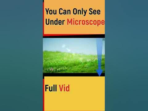 Microscope से दही को देख लेंगे तो कभी नहीं खाएंगे | 10 Things You Can Only See Under Microscope ...
