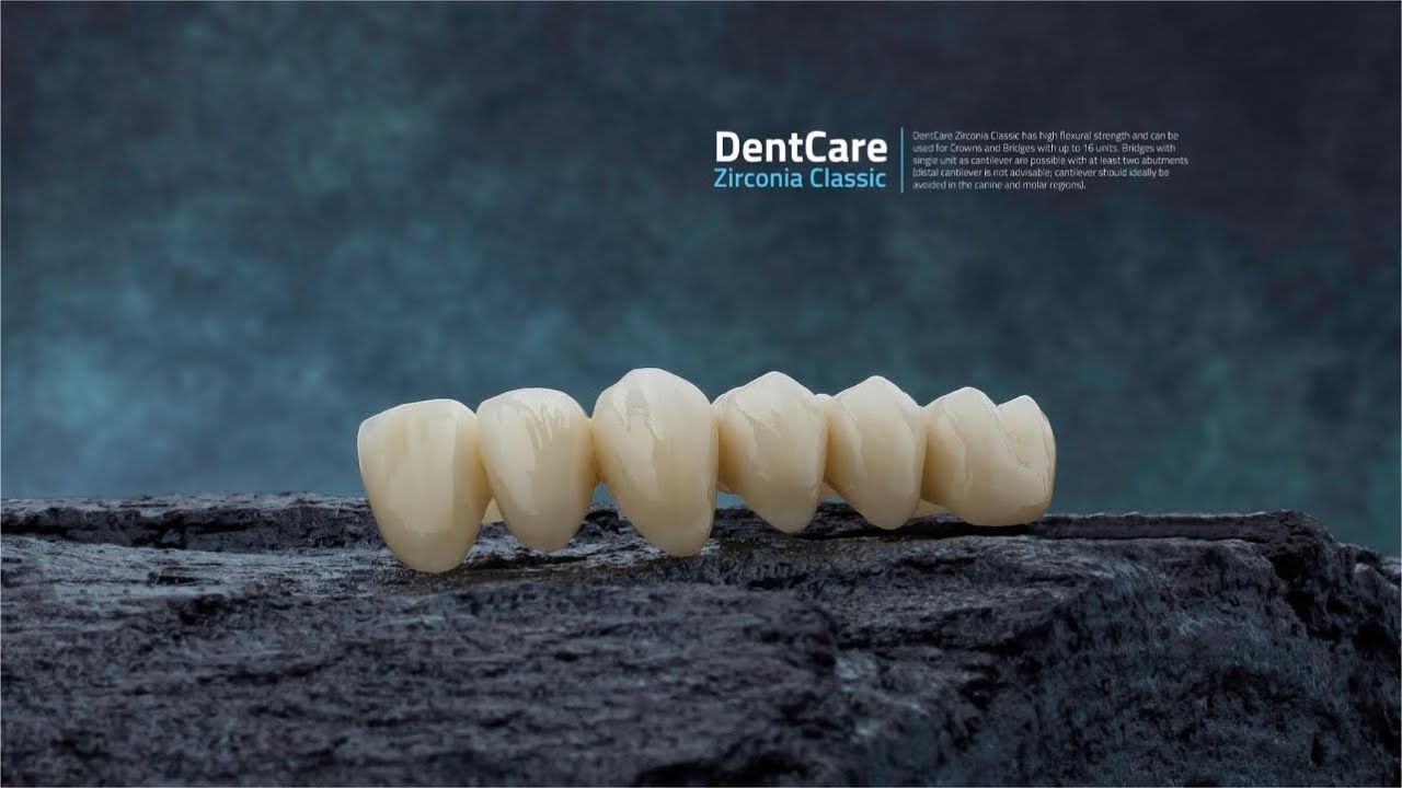 Zirconia Key and Keyway Split Bridge | Dr Brijesh Byrappa | Dental ...