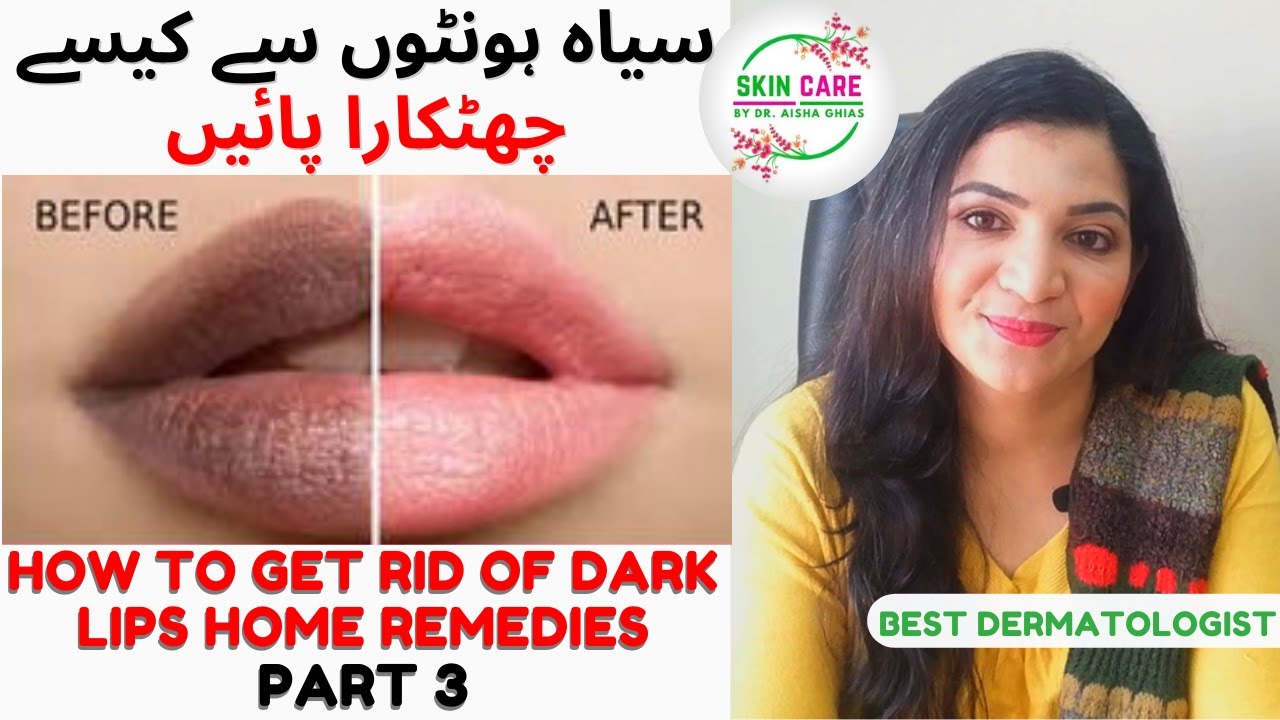 How to get Rid of Dark Lips Home Remedies | Dark Lips to Pink Lips ...