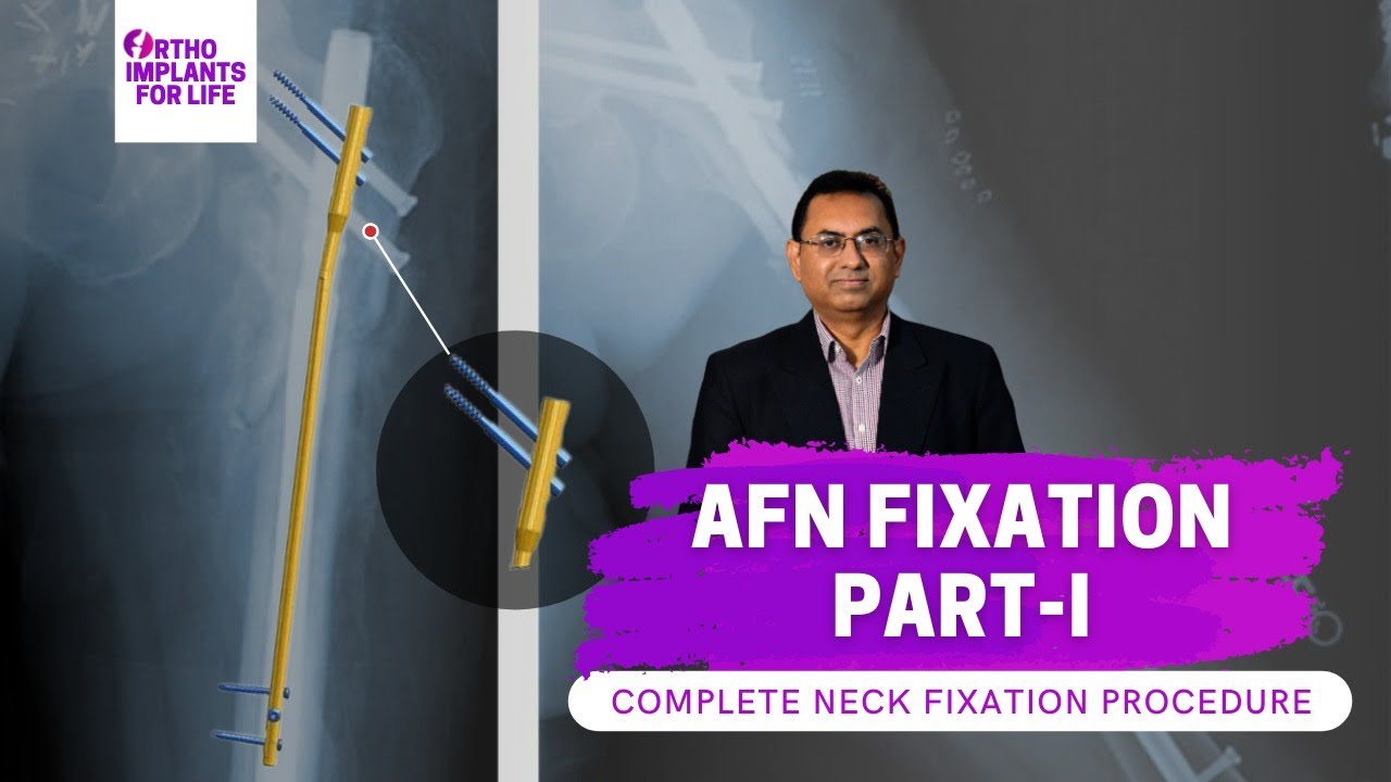 Anterograde Femoral Nail Fixation Procedure |AFN Neck Fixation - YouTube