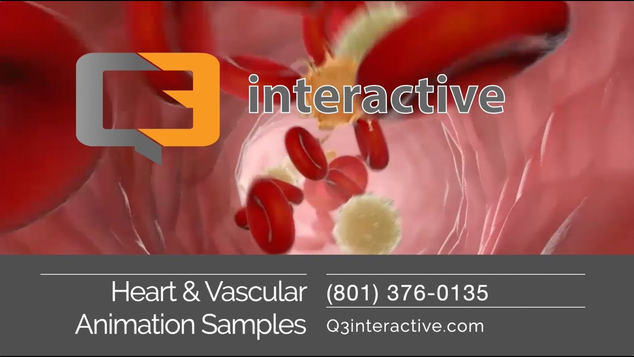 Q3 interactive Heart & Vascular Animation Reel - YouTube